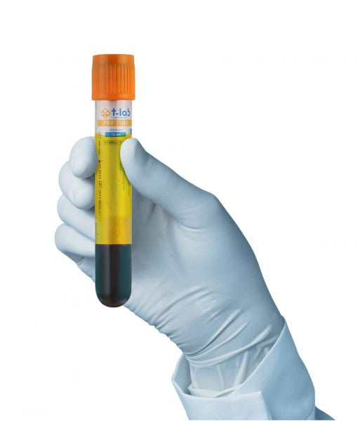 T-Lab PRP Tubes: Superior Quality and Platelet Recovery Rates ...